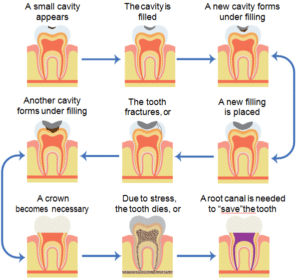 What is Biomimetic Dentistry? | Total Care Dental | Holistic Dentistry