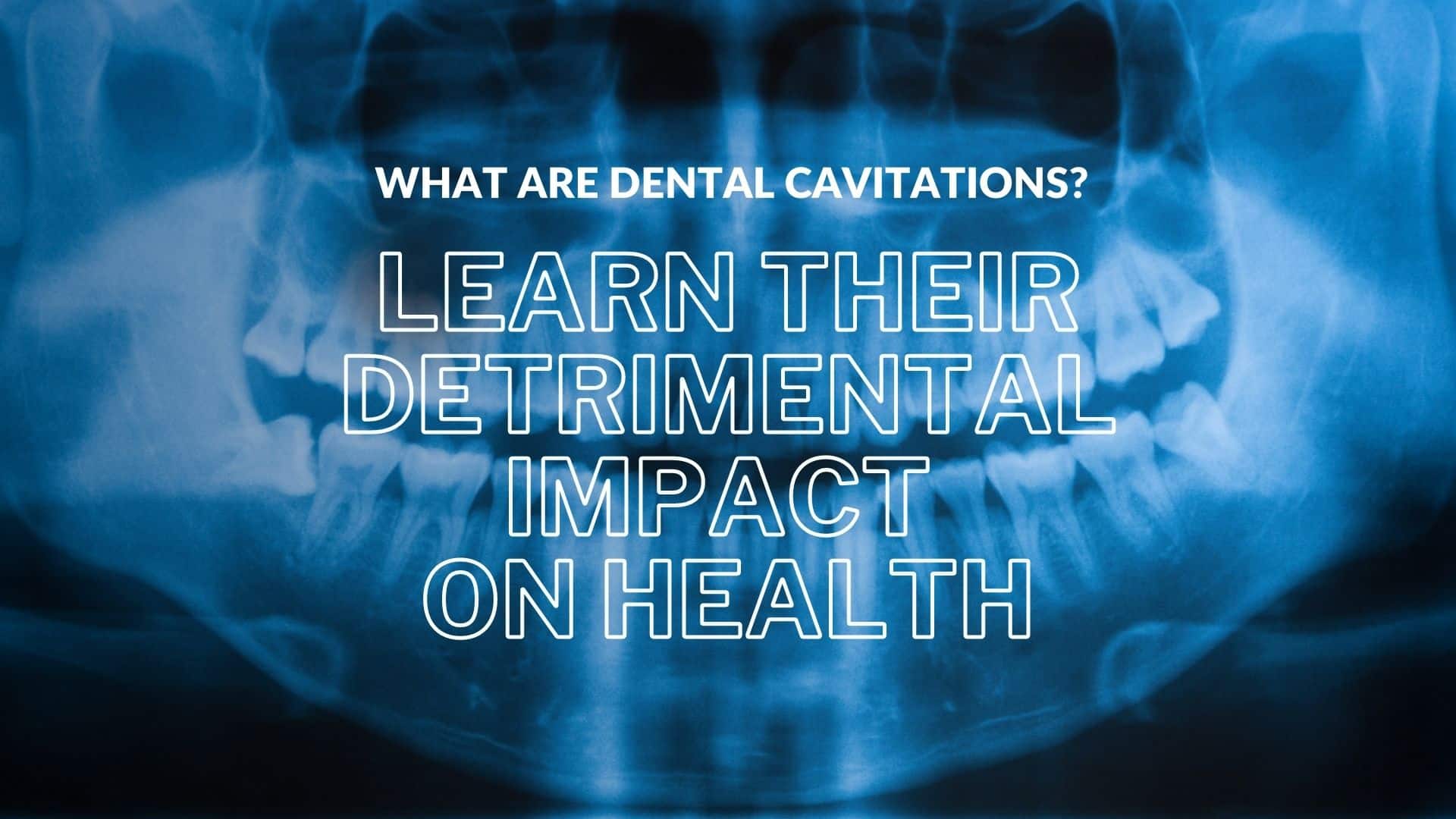 Dental Cavitations | Total Care Dental | Holistic Dentistry