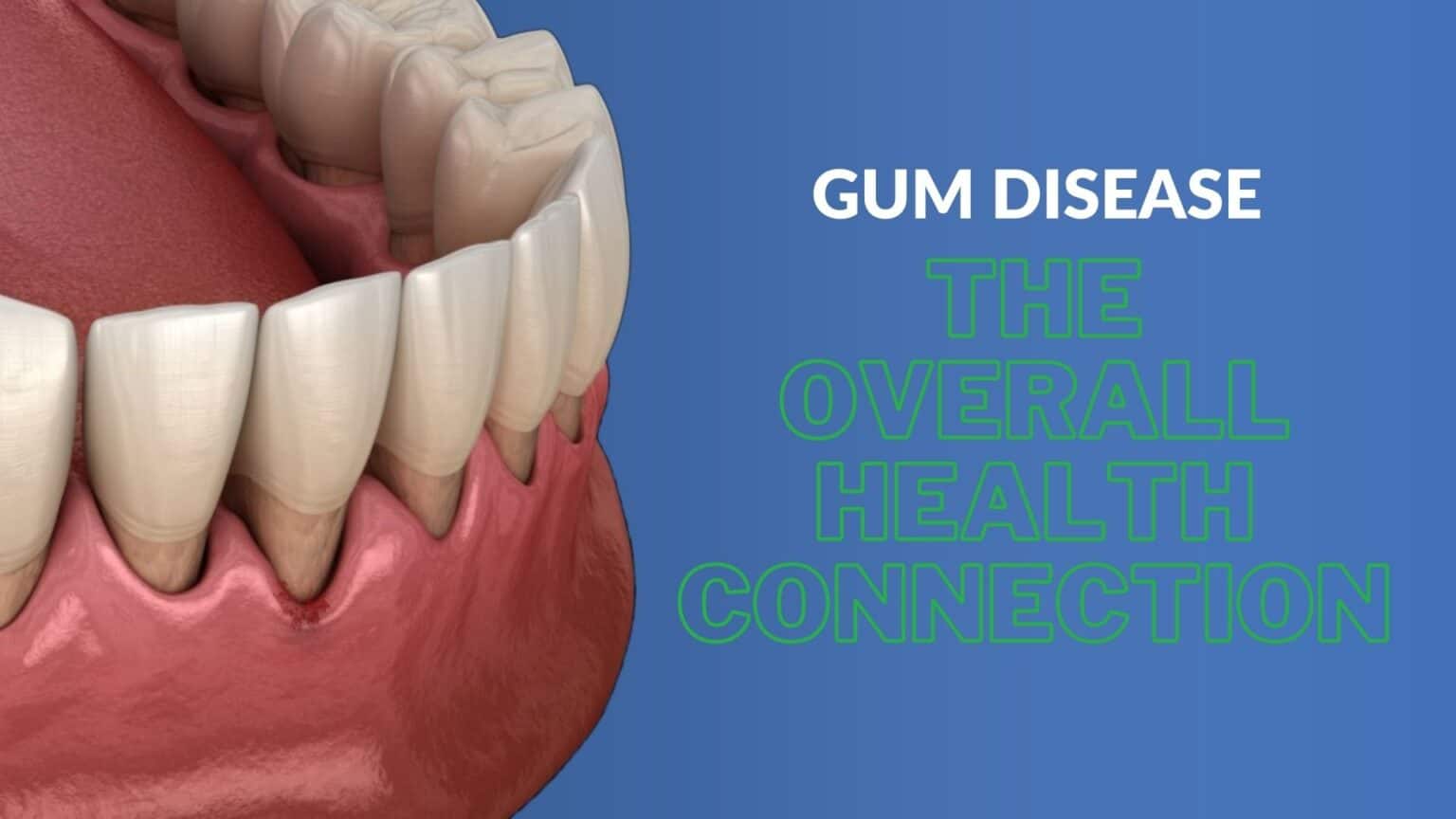 How To Reverse Tooth Decay | Total Care Dental | Holistic Dentistry