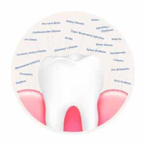 Gingivitis vs Periodontitis - The Mouth & Body Connection | Total Care ...