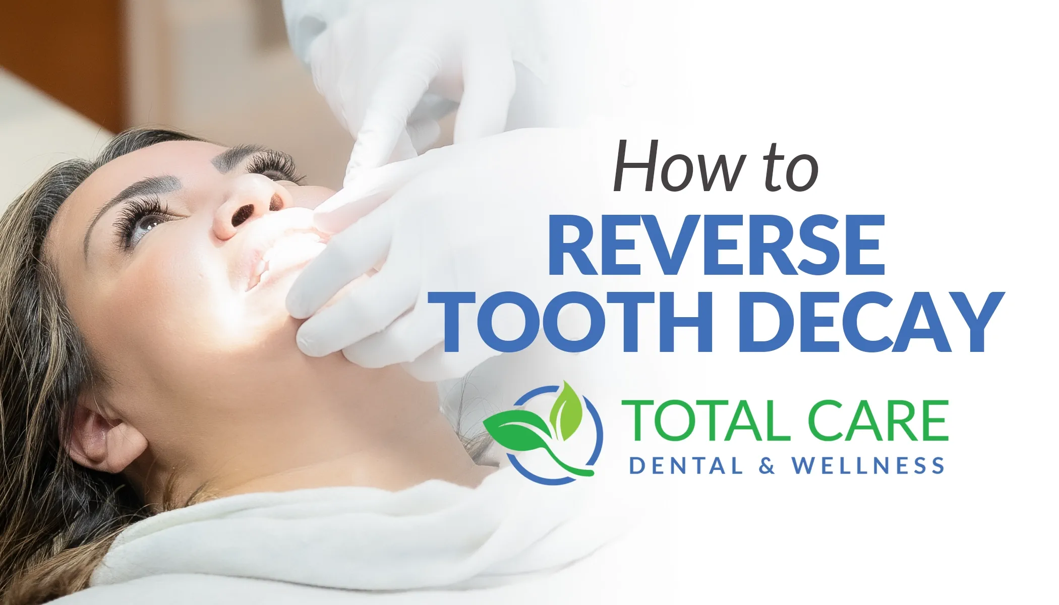 How To Reverse Tooth Decay | Total Care Dental | Holistic Dentistry