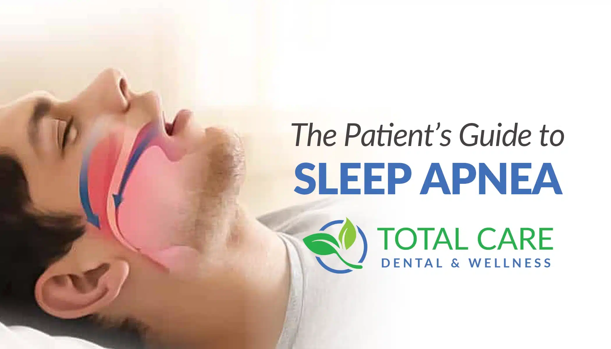 Patients' Guide to Sleep Apnea: Causes, Symptoms & Treatments