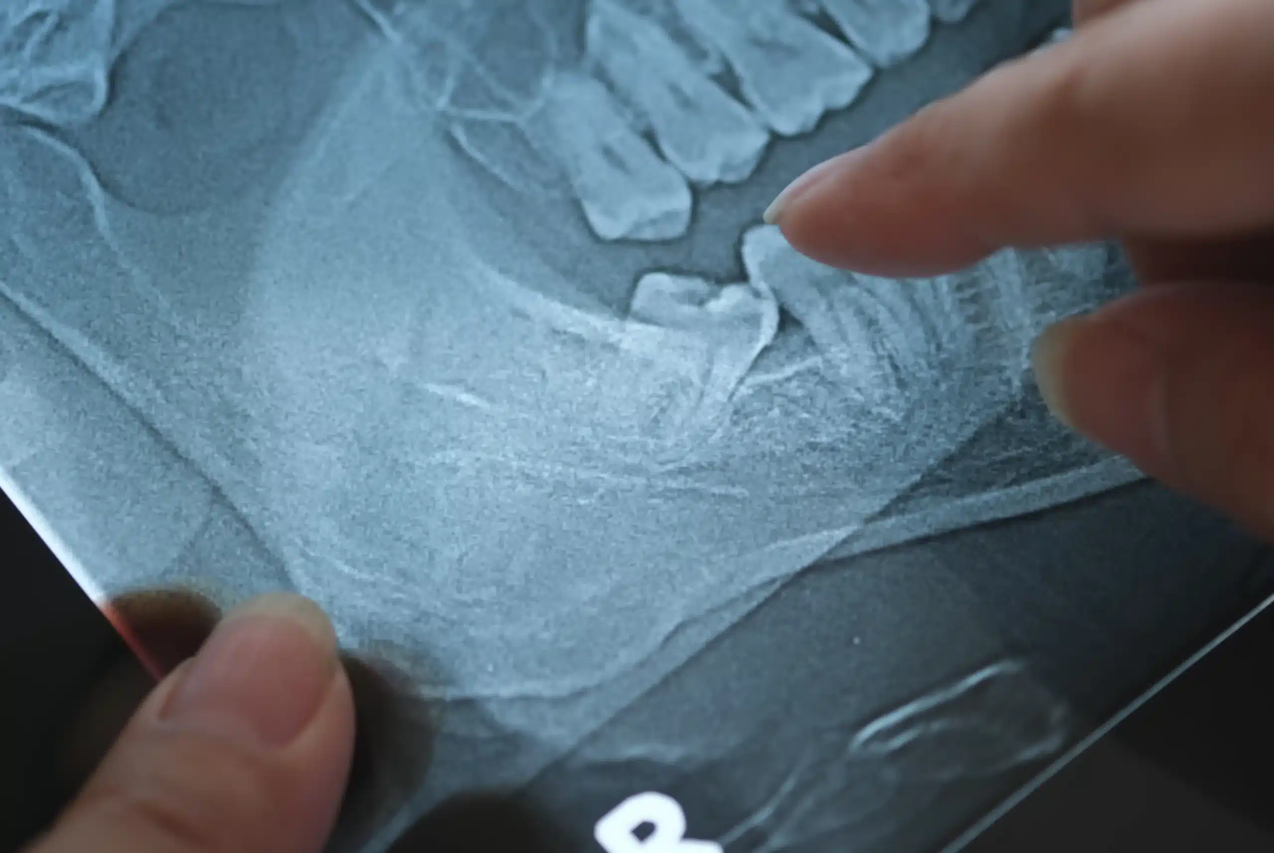 Biological Wisdom Tooth Removal | Total Care Dental | Holistic Dentistry